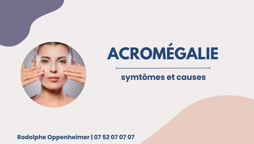 Acromégalie - Symptômes et Causes - Rodolphe Oppenheimer